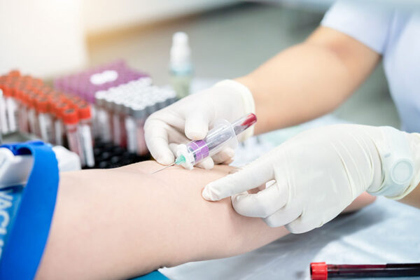 Why You Should Test for Allergies